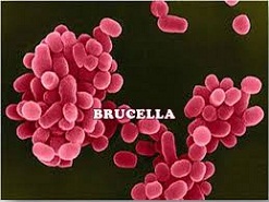 What is Brucellosis? Symptoms, diagnosis, treatment