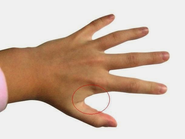 Wellness Lab Health Info: 03/11/15