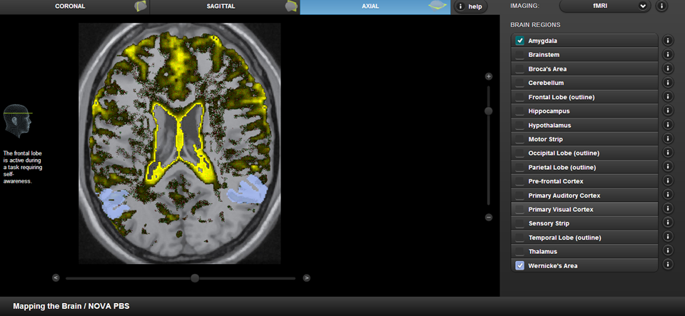 Teaching High School Psychology: Mapping the Brain: Brain Scans-New ...