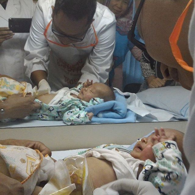 Stoma Care In Infants ~ Clinic Griya Husada Center