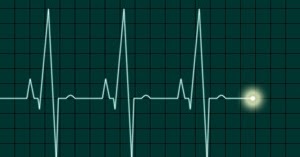 Heart and Aorta: Electrocardiography (ECG) Procedure Explained
