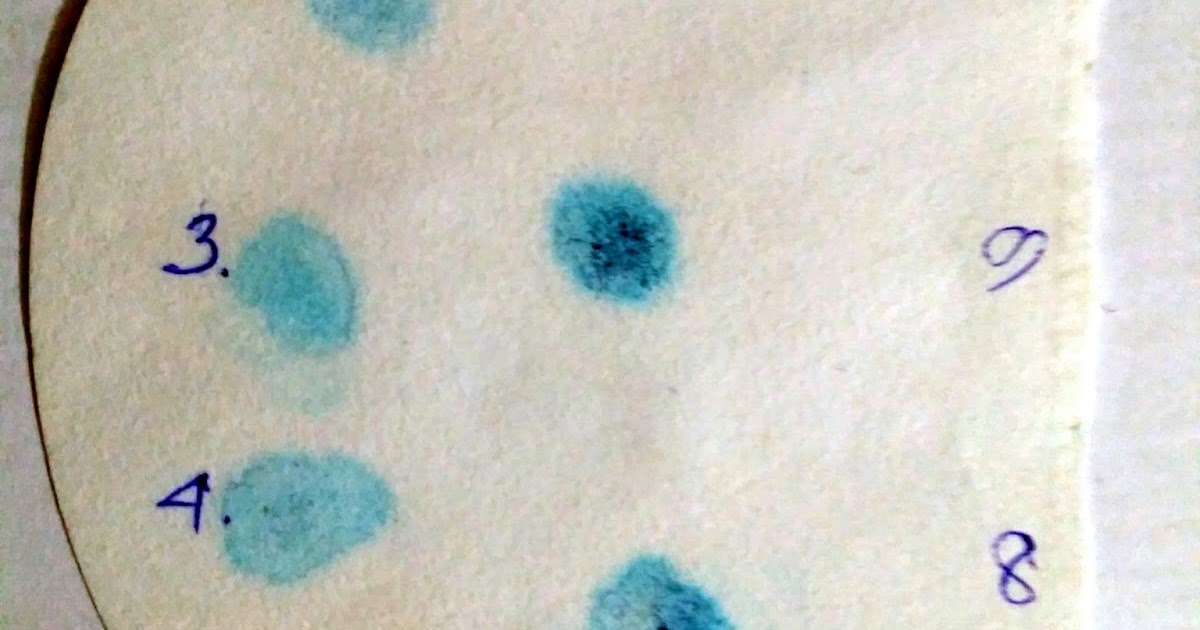 Civil Engineering: Methylene Blue Index for Clay