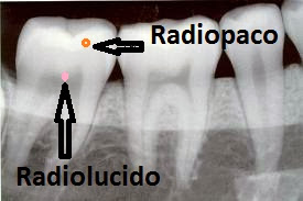 RADIOPACIDAD Y RADIOLUCIDES ~ BASES DE BIOFISICA
