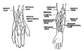 Mata Kuliah Kebidanan: Macam-macam vena untuk pemasangan infus