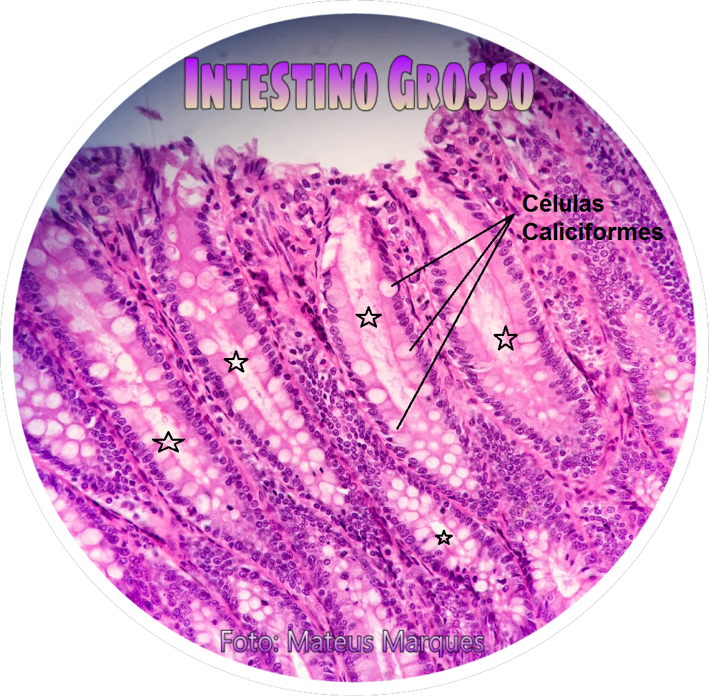 Intestino Grosso