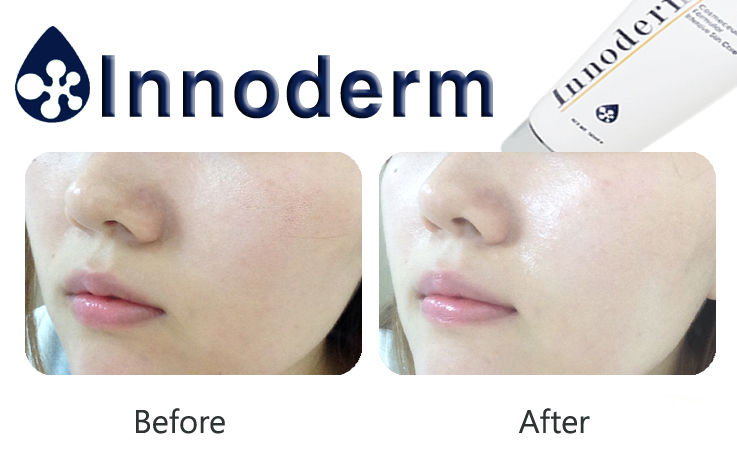 Only Medical 온리메디칼: Only Medical Skin care product : Innoderm (repair ...