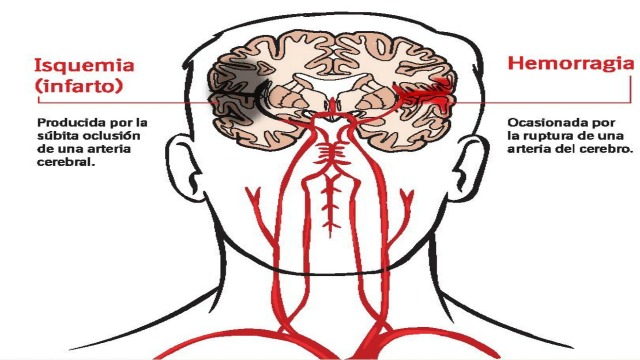 REHABILITACION NEUROLOGICA Y FISIOTERAPIA: 2015