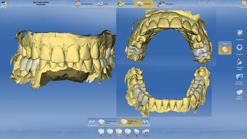 DENTALMAX: LABORATORIO ODONTOTECNICO CON CENTRO FRESAGGIO CAD/CAM ...