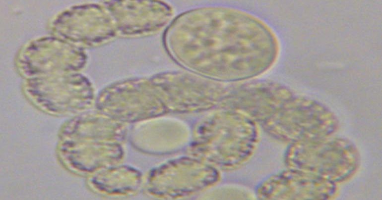 ASOCIACION ECOLOGISTA RIO MOCORETA: CIANOBACTERIA Anabaenopsis milleri ...
