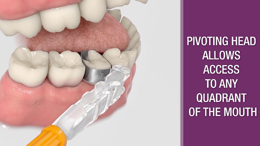 ULTRADENT: NEW Omni-Matrix Disposable Retainer and Matrix Band
