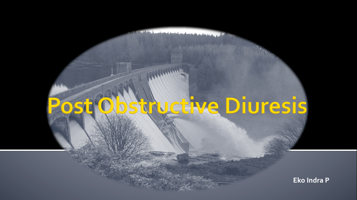 Post Obstructive Diuresis | Sense Heal