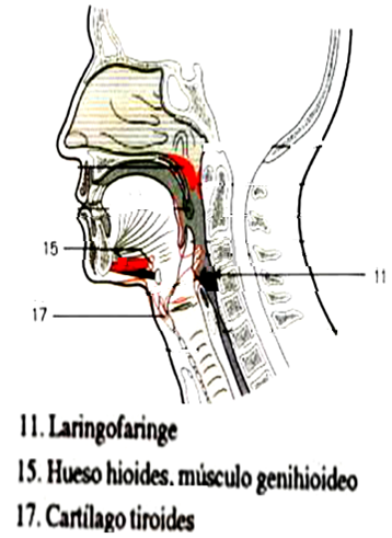 Todo para el Radiologo: LARINGOFAINGE O HIPOFARINGE