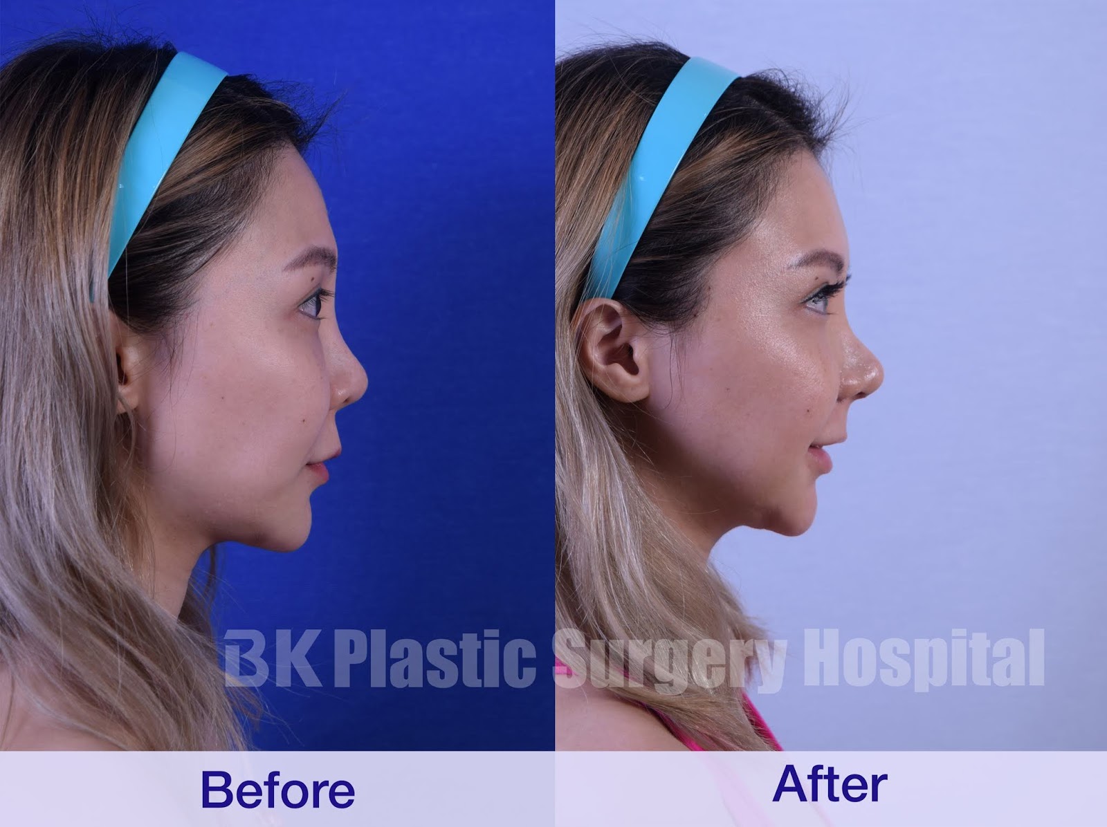 BK Plastic Surgery
