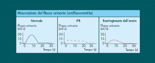 UROFLUSSOMETRIA : ESAME URODINAMICO