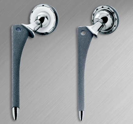 OSSA CARPALIA ©: COXARTROSIS SECUNDARIA A DISPLASIA ACETABULAR BILATERAL