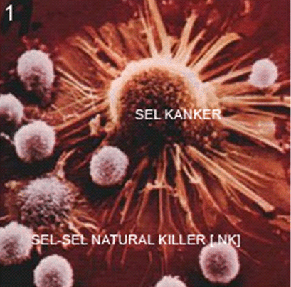 Menuju Hidup Sehat: PENYAKIT KANKER, GEJALA, FAKTOR PENYEBAB ...