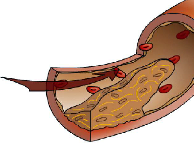INFARK MIOCARDIUM - Mydokterhewan