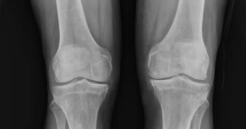 Tu Espacio Radiológico: Proyecciones Básicas de Rodilla