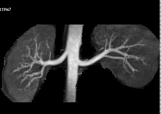 My Radiology World: Non-contrast MRA of ArterIes and Veins