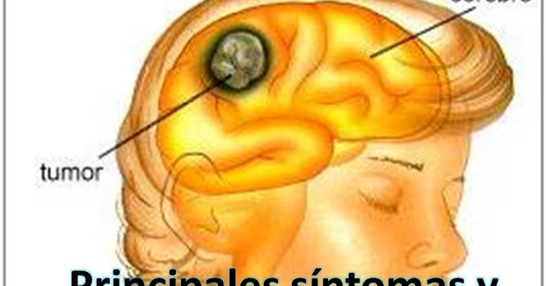 Principales síntomas y señales de un Tumor. - ★ MUNDO MEDICINAL