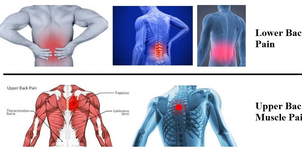 Lower Back Pain Solutions and Upper Back Muscle Pain Relief
