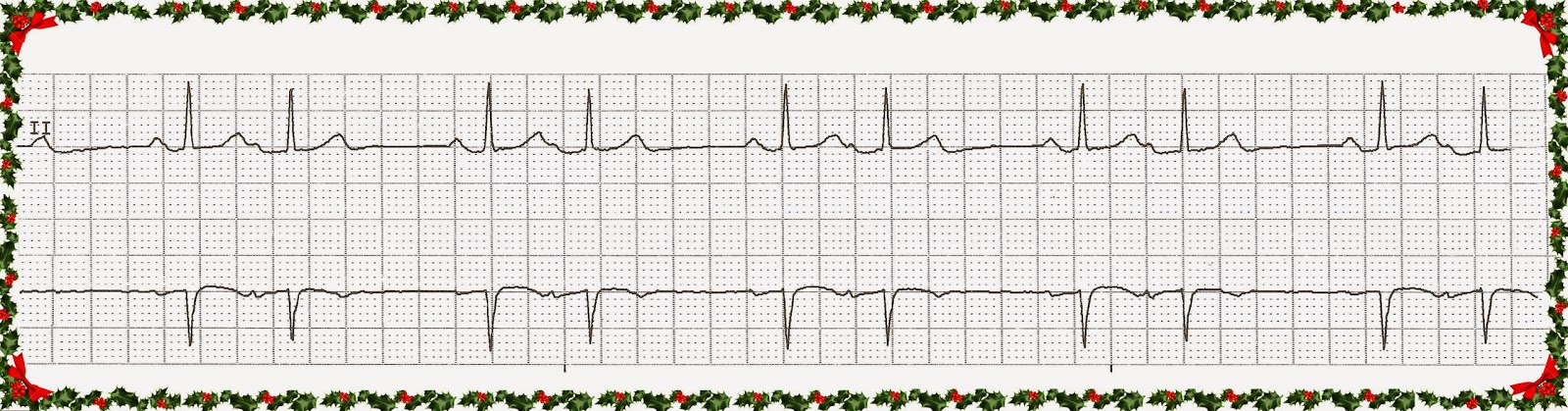 Practice EKG Strips Merry Christmas