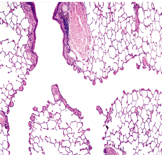 Neumocitos Tipo 2 Funcion