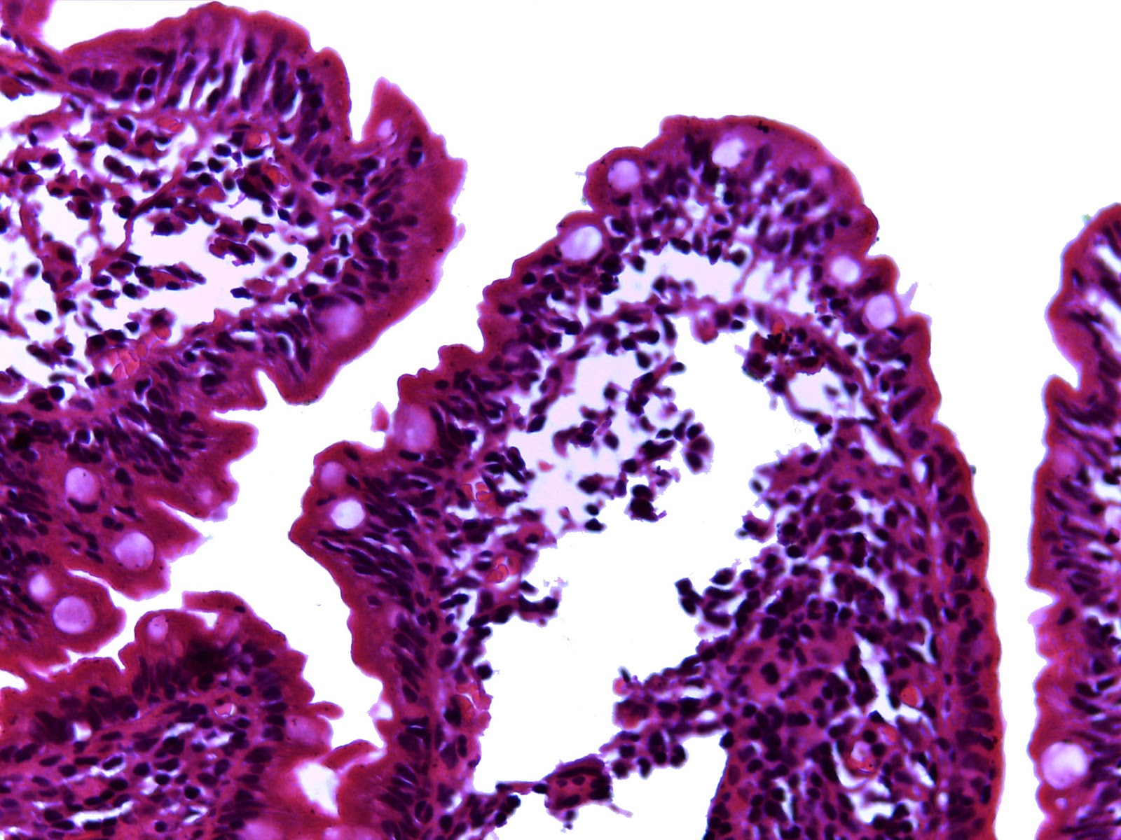 GASTROINTESTINAL AND LIVER HISTOLOGY PATHOLOGY ATLAS: DUODENUM: VILLOUS ...