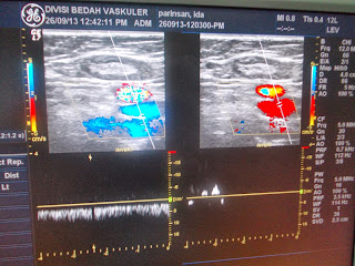 RUANG PRAKTEK BEDAH - DOKTER RAMZI SPB (K) V: Gambaran reflux pada ...