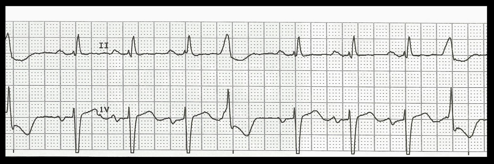 EKG Rhythm Quiz 272