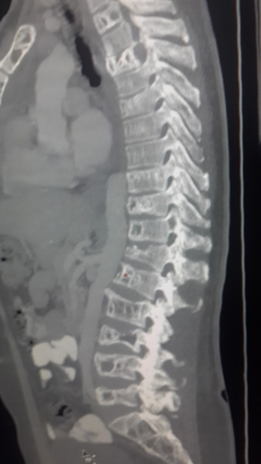EL RINCÓN DE LA MEDICINA INTERNA: 08/01/2016 - 09/01/2016