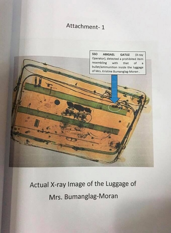 Investigation results of alleged ‘Tanim Bala’ released, X-ray photo shown