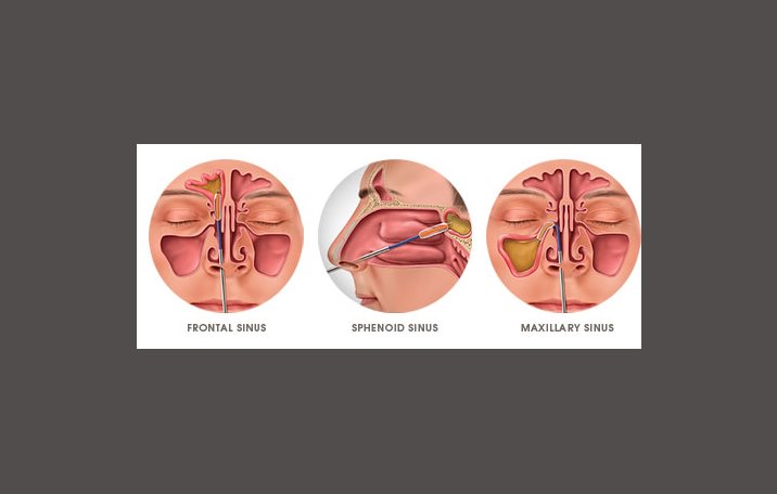 Hidung : Pengertian, Struktur, Fungsi, Cara Kerja - Asep Respati