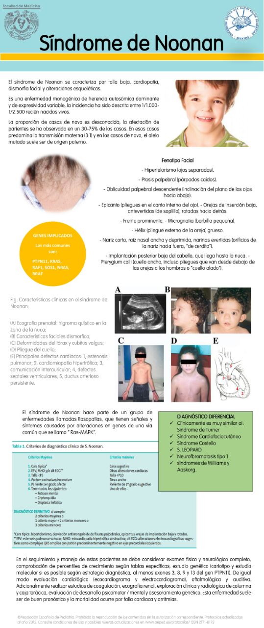 síndrome de Noonan, cartel