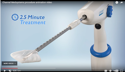 Ob/Gyn Updated : Cerene cryotherapy device for Endometrial ablation ...