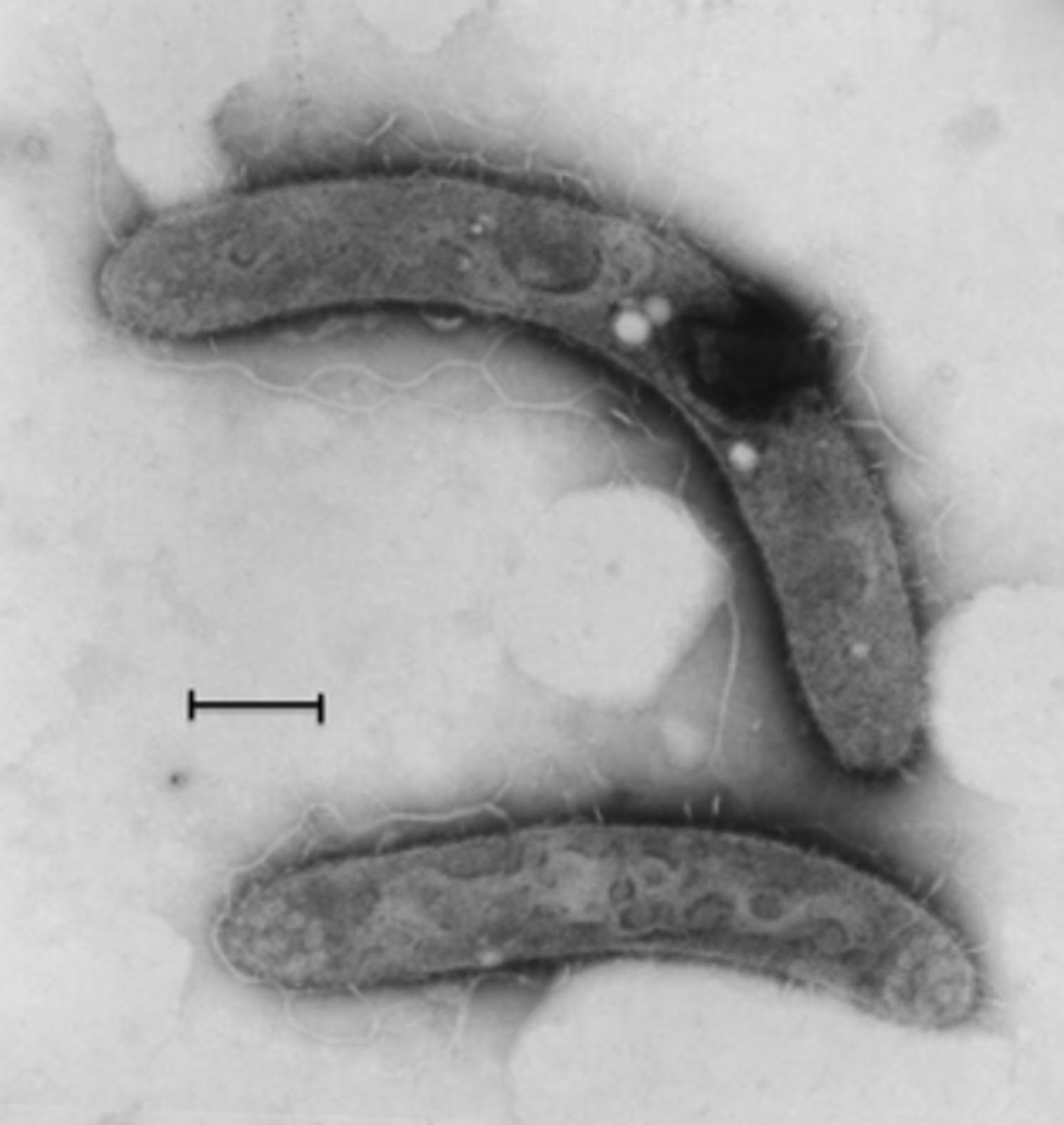 Mikrobai: Salinibacter ruber ~ Mikrobiologija - kas tai?