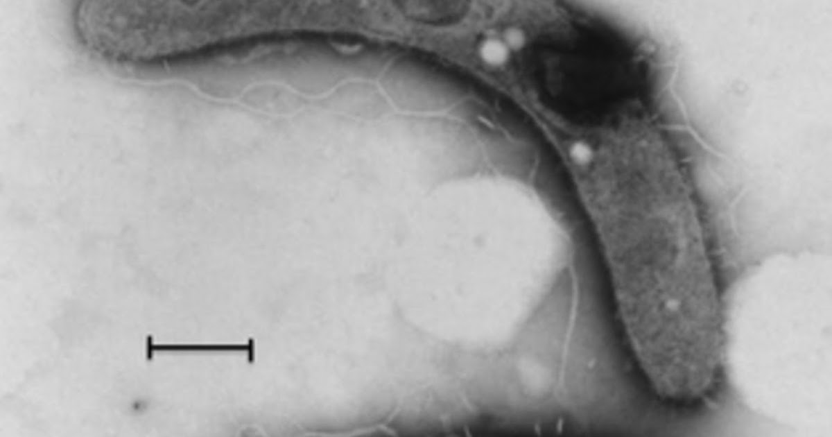 Mikrobai: Salinibacter ruber ~ Mikrobiologija - kas tai?