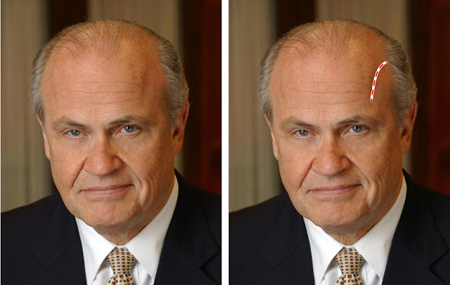 Human Anatomy for the Artist: The Temporal Line: There's a Kansas City ...