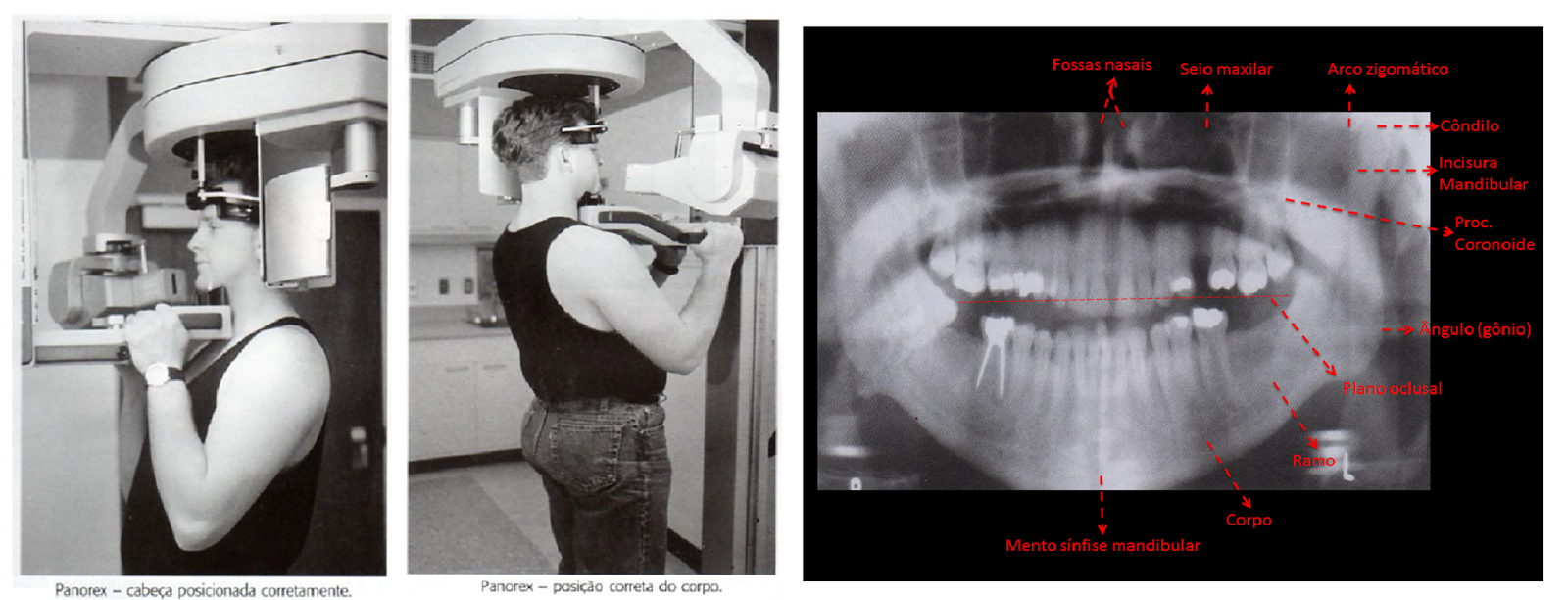 Laboratório de Roentgen: Crânio e Face