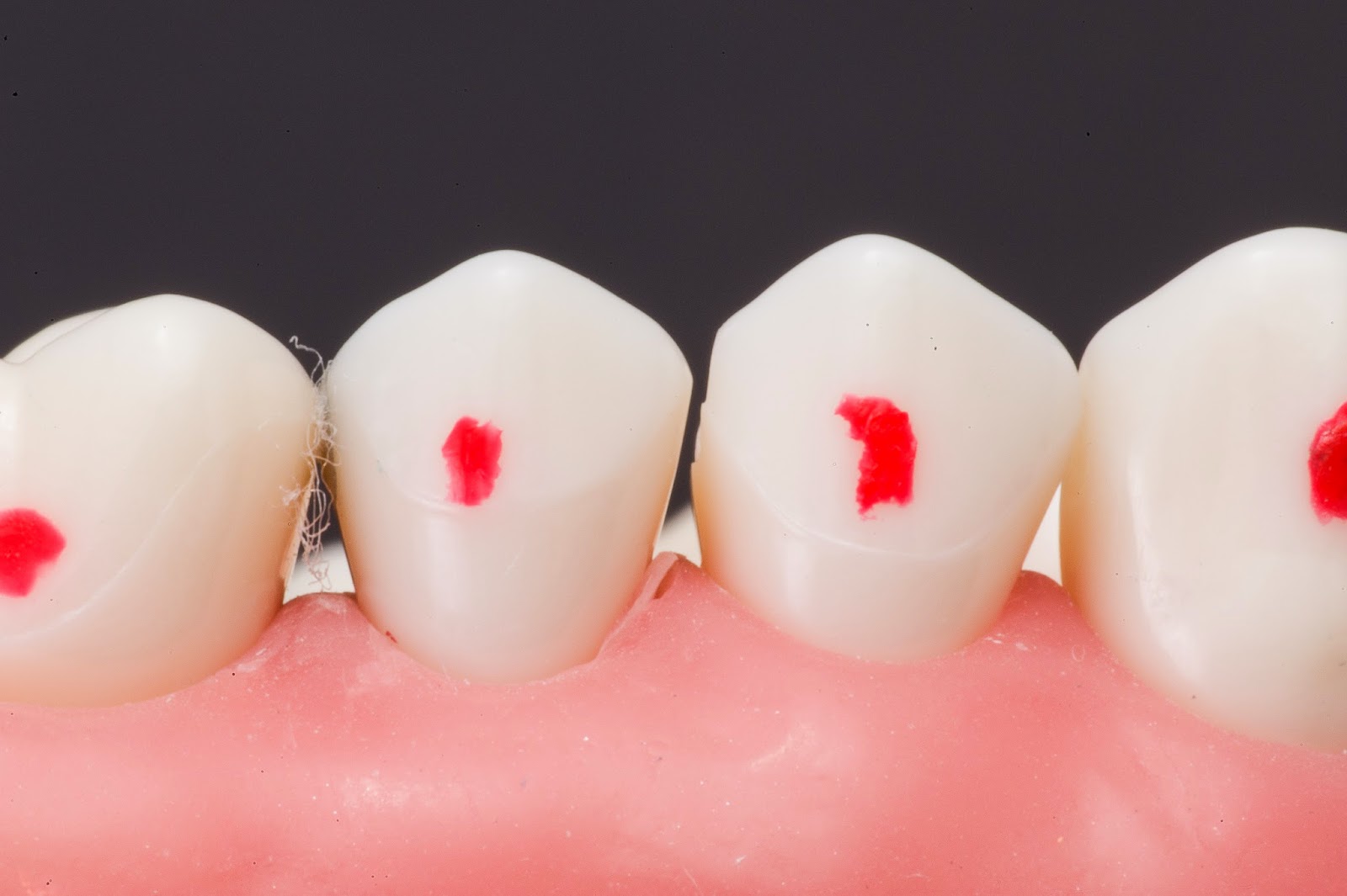 Dental Term Mod at Randy Eubanks blog