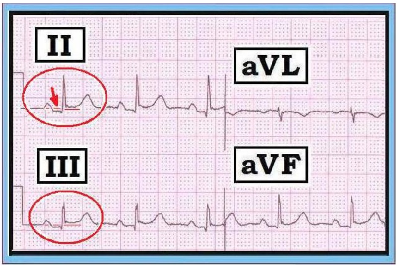 ftpx.dll download - Home