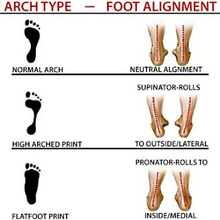 PENAPERTAHANAN: Tapak Kaki 'Flat Foot'