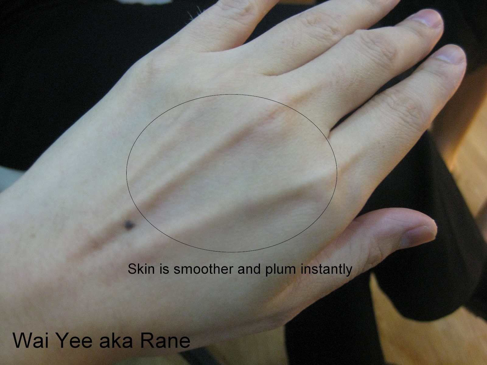 The Beauty Junkie - ranechin.com: Clique Clinic - Your neighborhood ...