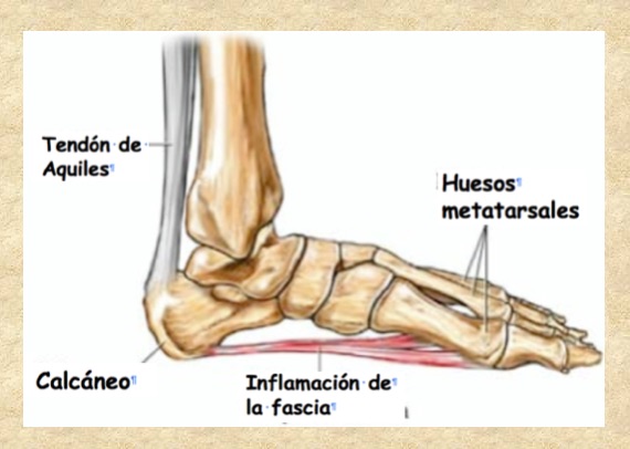 Vampiro Erudito: Hueso Calcáneo