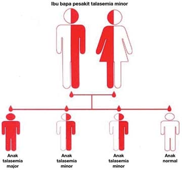 nad: TALASEMIA (Thalassemia) - PART 1