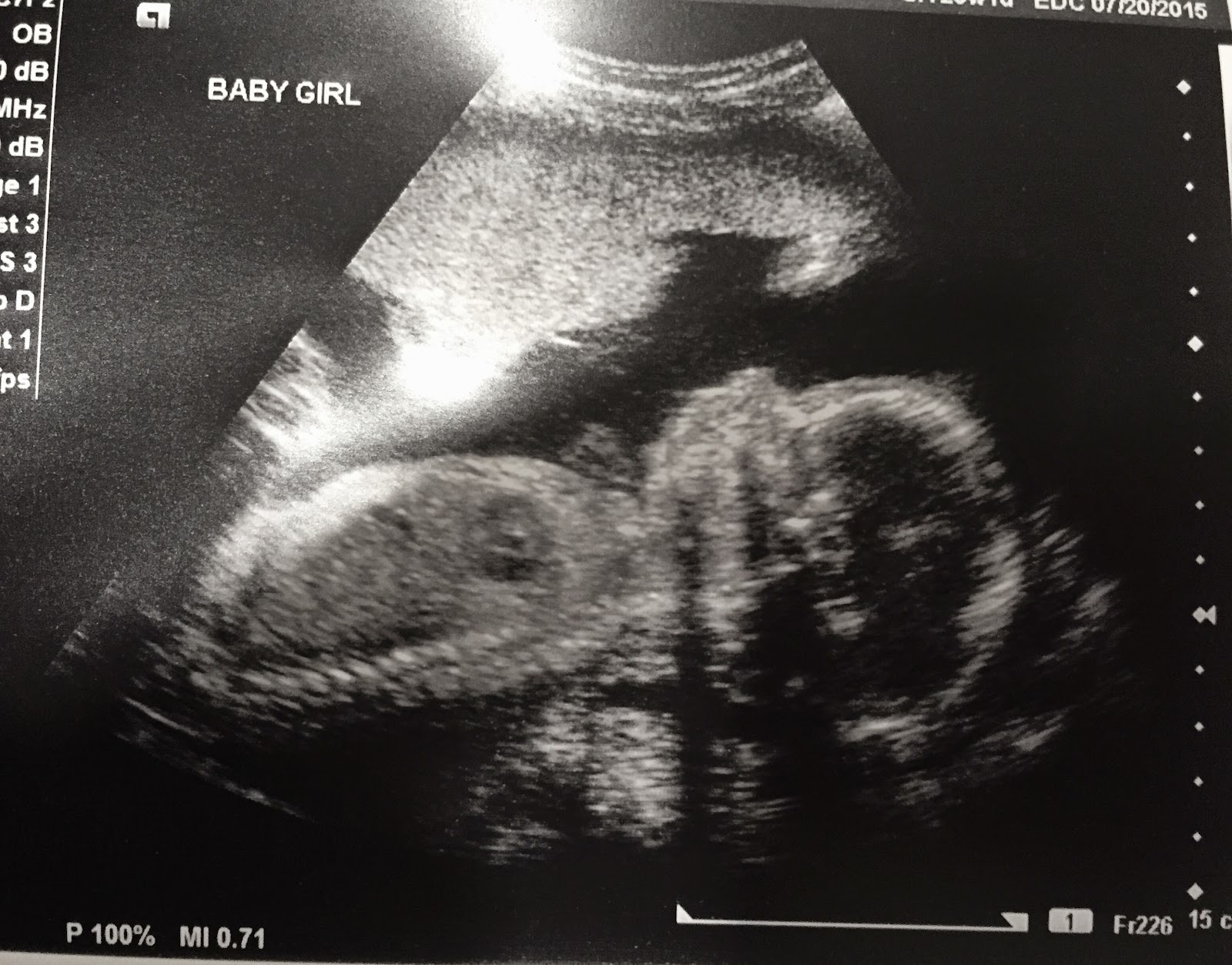 PB+J Babes: 20 weeks + baby update