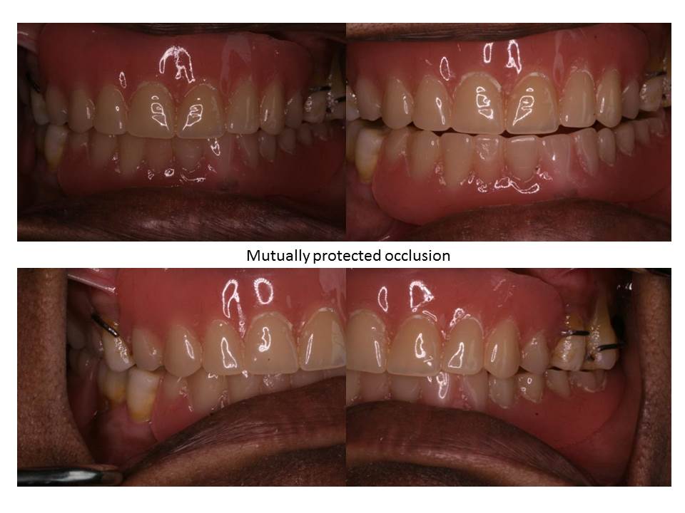 When a quack fixes your teeth!