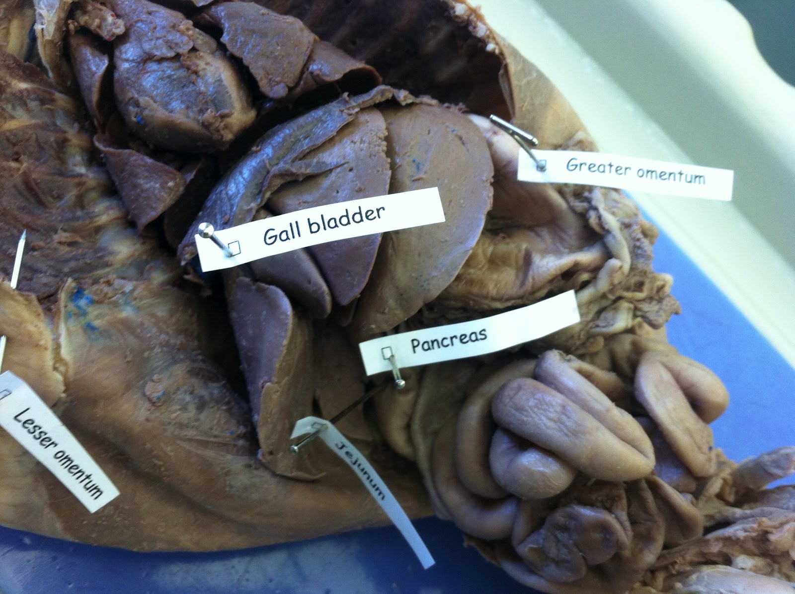 Cat Dissection: Human Anatomy: Digestive System