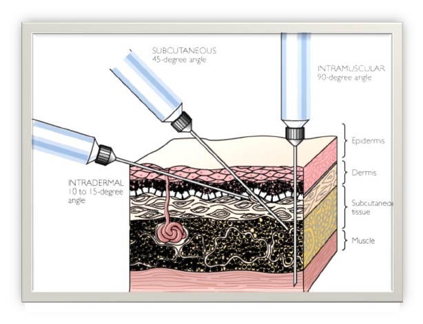 heaven: TEHNIK PENYUNTIKAN