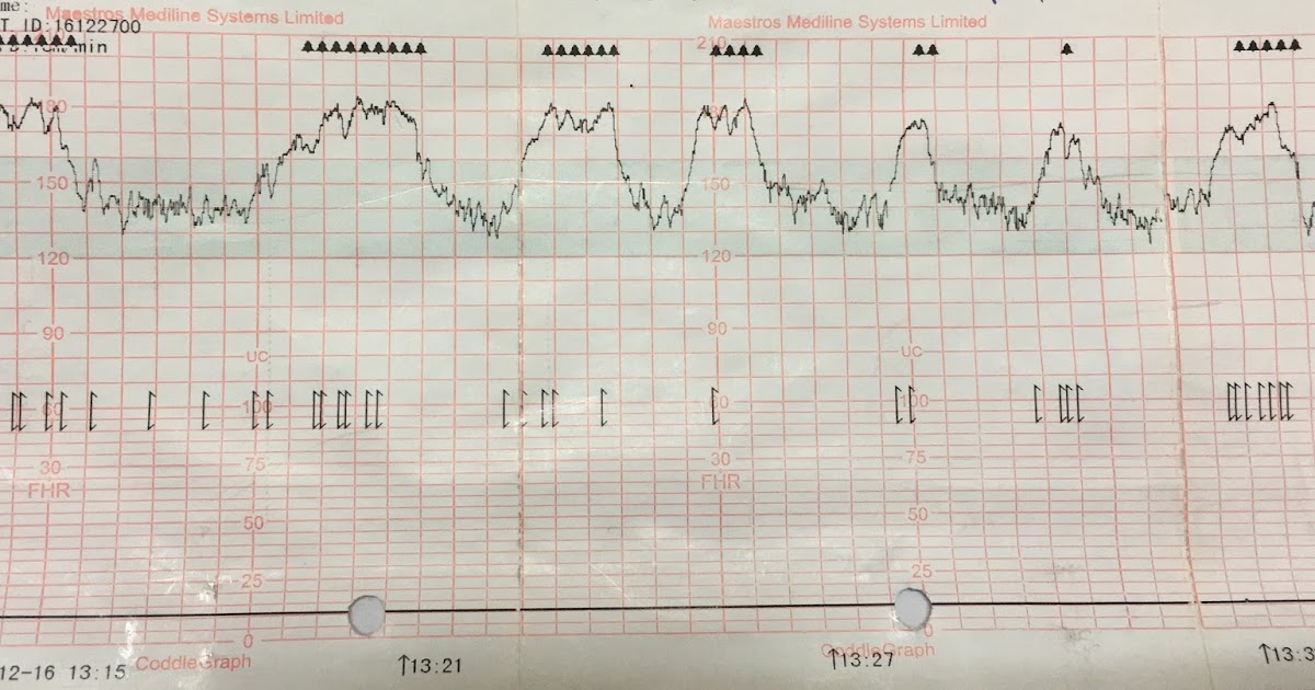 Journal of Postgraduate Gynecology & Obstetrics: Interpretation Of An ...